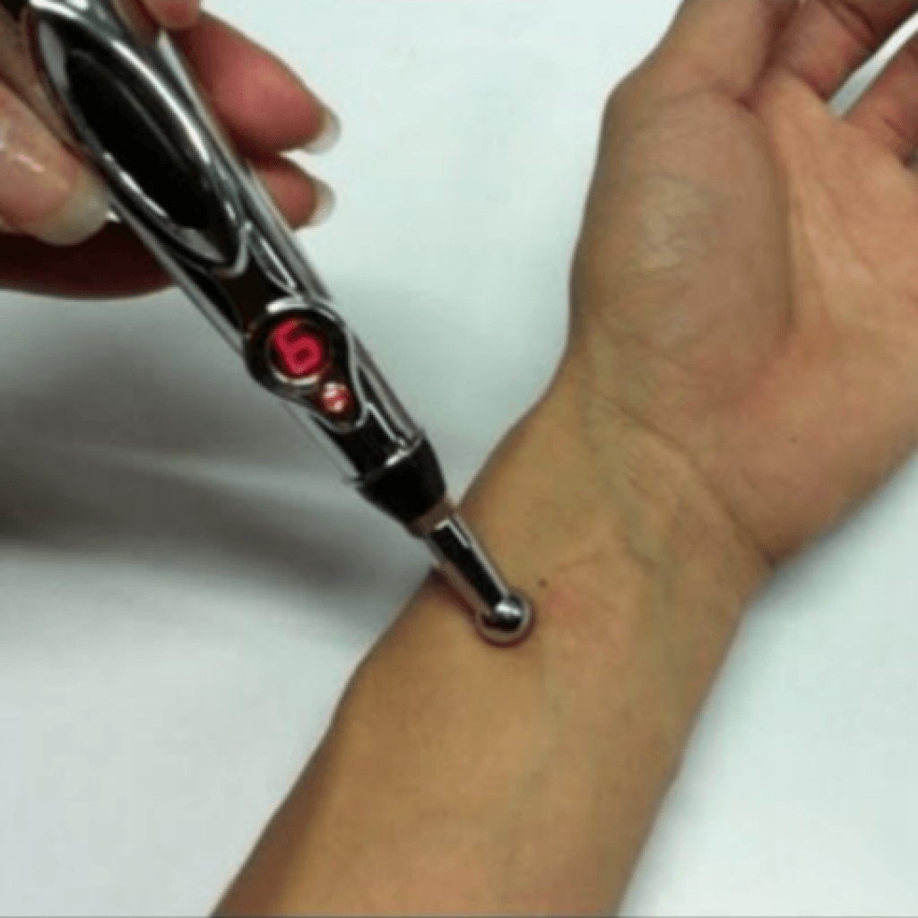 Electric Acupuncture Pen Relieves Joint And Muscle Pain - Legit Gifts